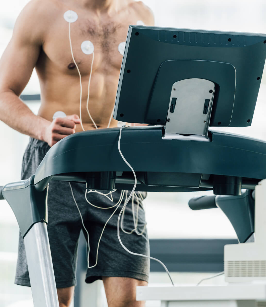 Stress Echocardiogram | Pensinsula Cardiology Group