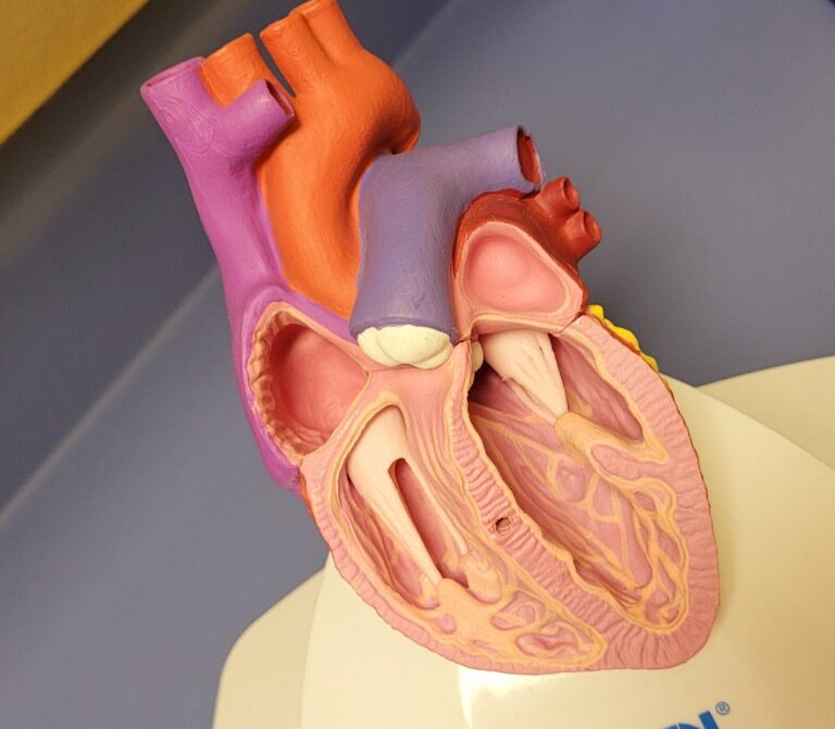 Percutaneous Coronary Intervention (PCI) | Pensinsula Cardiology