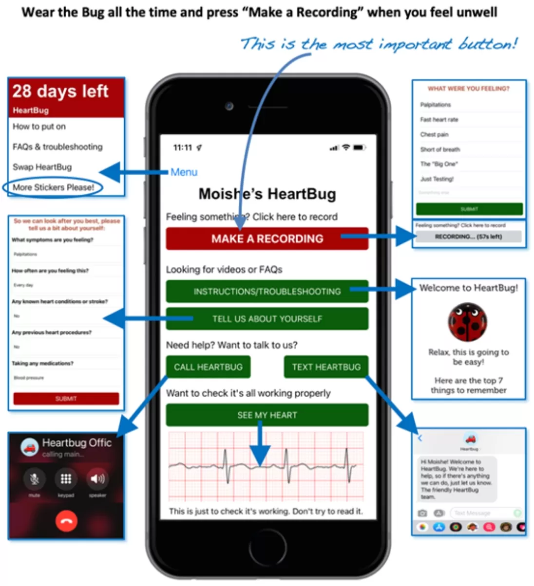 Heart Bug | Pensinsula Cardiology Group